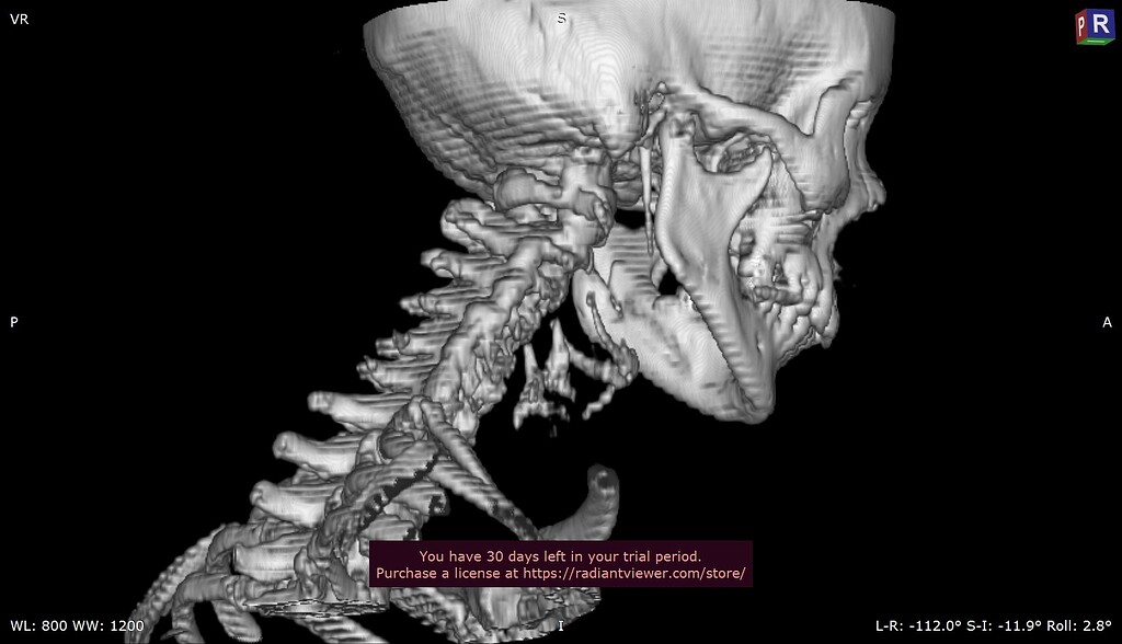 I am new here and would love some help with my native ct scans ...