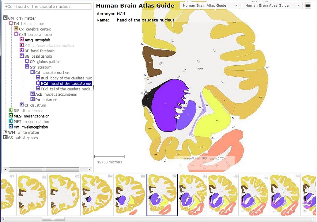 Allen Human Brain Reference Atlas - Reference Atlases - Allen Brain Map Community Forum