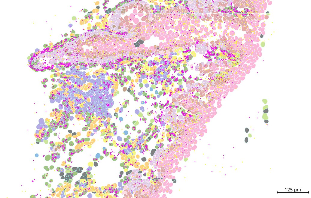 Napari_spatialdata colouring cell_labels and plotting specific transcripts - spatialdata - scverse