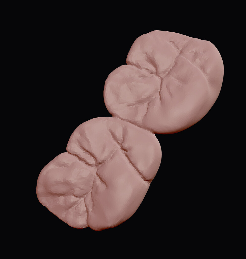 How can I replicate exocad’s smooth shading for my tooth model in Three.js? - Questions - three ...